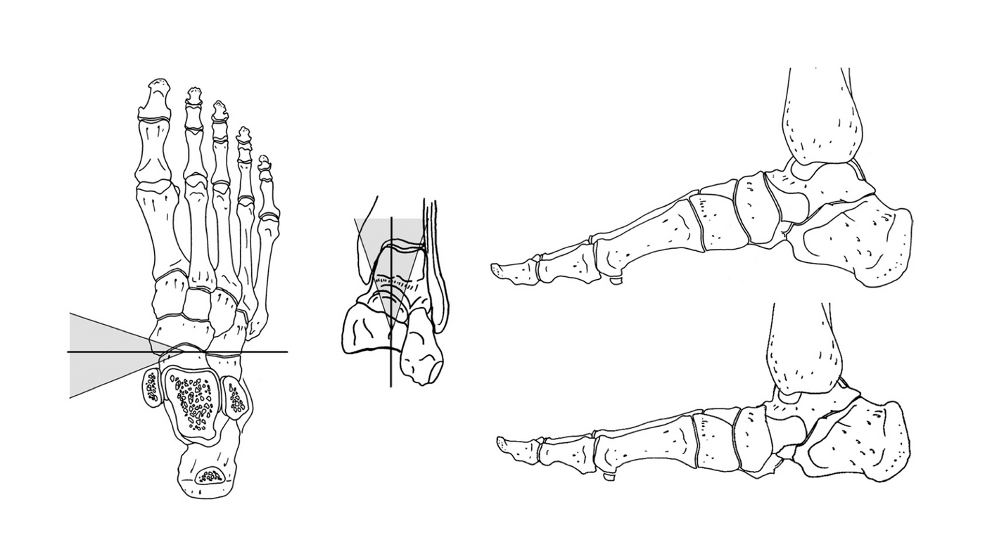The Jargon of Pedal Movements - definition of terms - My Foot Function